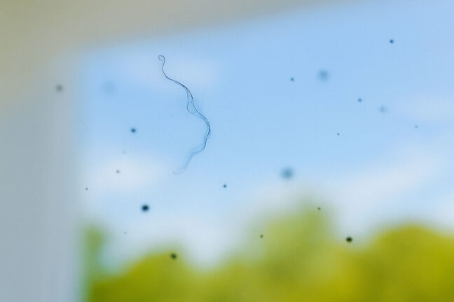 Posterior Vitreous Detachment | West Texas Eye Associates